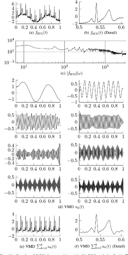 Variational Mode Decomposition Semantic Scholar