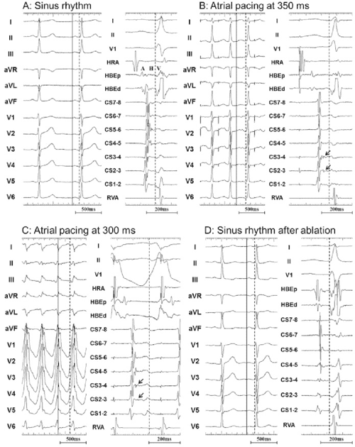 Figure 1 from Antegrade and Retrograde Decremental Conduction ...