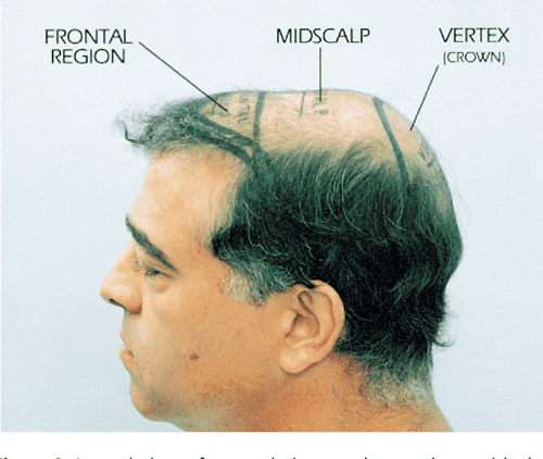 Figure 1 from Nomenclature Proposal for the Zones and Landmarks of the ...