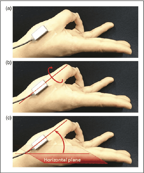 Figure 3 from Measurement of thumb pronation and palmar abduction ...