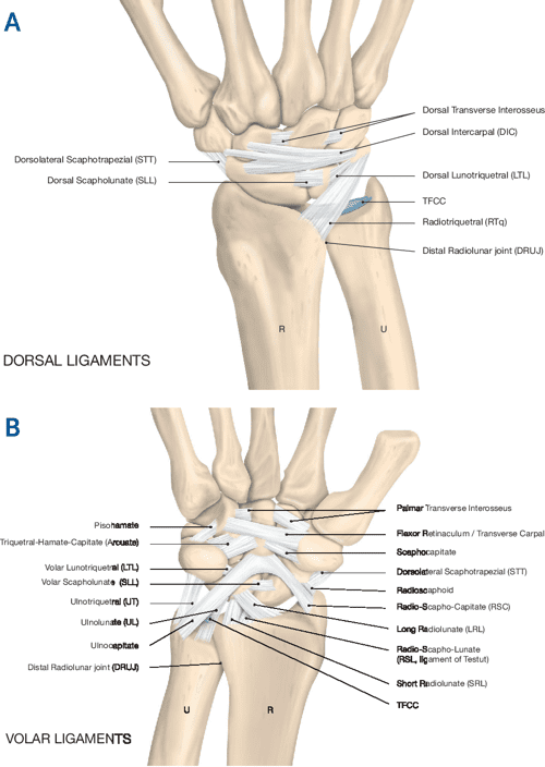 Figure 1 from Clinical and arthroscopic assessment of wrist ligament ...