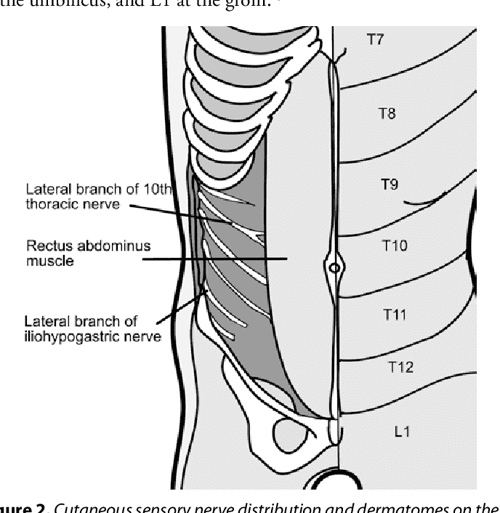 Figure 7 from Ultrasound guided rectus sheath block-analgesia for ...