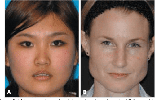 Figure 1 from Nonsurgical reshaping of the lower face. | Semantic Scholar