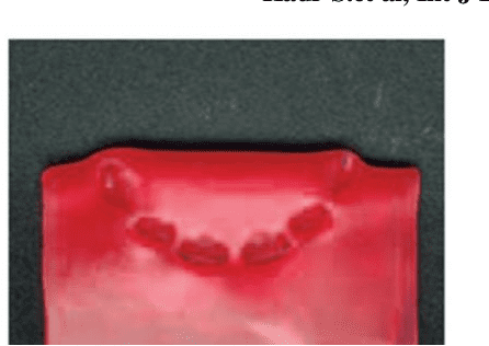 BITE MARK ANALYSIS IN FORENSIC ODONTOLOGY | Semantic Scholar