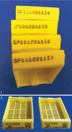 Table 2 from Uniform Labeling of Blocks and Slides in Surgical ...