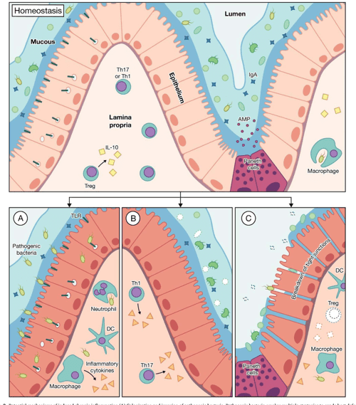 Figure 1 from Microbiome and colorectal cancer: Unraveling host ...