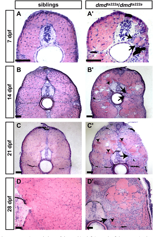 Figure 1 from Dystrophin-deficient zebrafish feature aspects of the ...