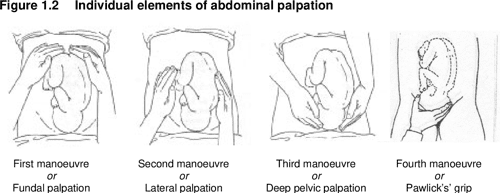 Figure 1.1 from Abdominal palpation to determine fetal position at the ...