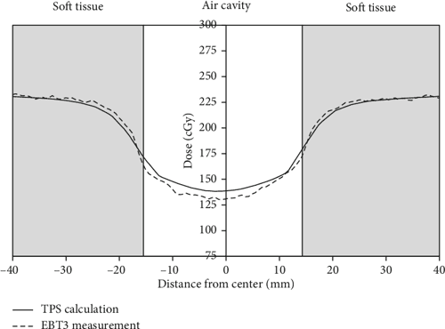[pdf] Accuracy Evaluation Of Collapsed Cone Convolution Superposition