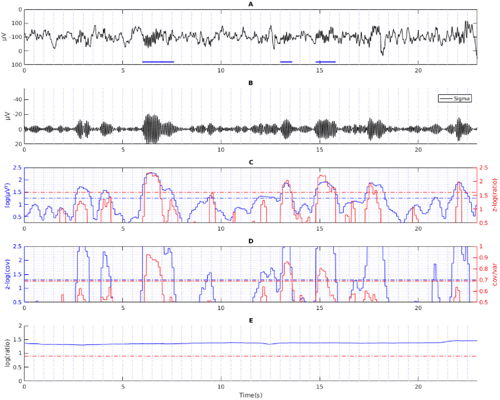 Figure 5 From A Sleep Spindle Detection Algorithm That Emulates Human