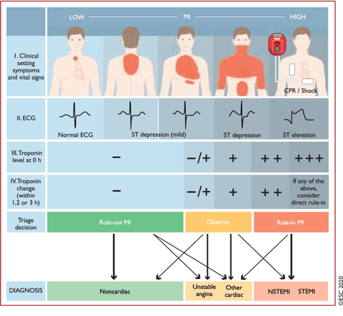[PDF] 2020 ESC Guidelines for the management of acute coronary ...