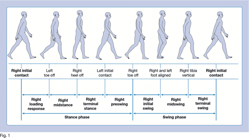 Figure 1 from Instrumented Gait Analysis: A Tool in the Treatment of ...