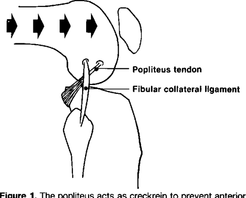 Figure 1 from Avulsion of the popliteus tendon | Semantic Scholar