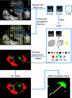 Automatic Estimation of Fetal Abdominal Circumference From Ultrasound ...