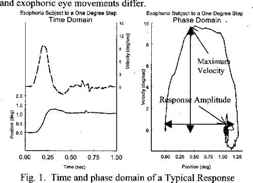 [PDF] Dynamic analysis comparing esophoria and exophoria | Semantic Scholar