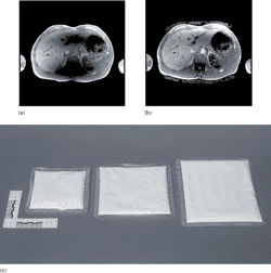 Figure 1.1 from Efficient computational methods in Magnetic Resonance ...