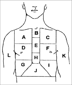 Figure 5 from Usefulness of chest pain character and location as ...