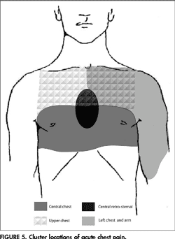 Figure 5 from Usefulness of chest pain character and location as ...