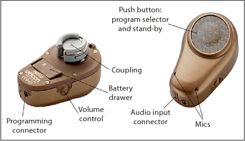 Figure 1 from The Ponto bone-anchored hearing system. | Semantic Scholar