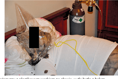 Figure 3 from Suicidal asphyxiation by using helium - two case reports ...